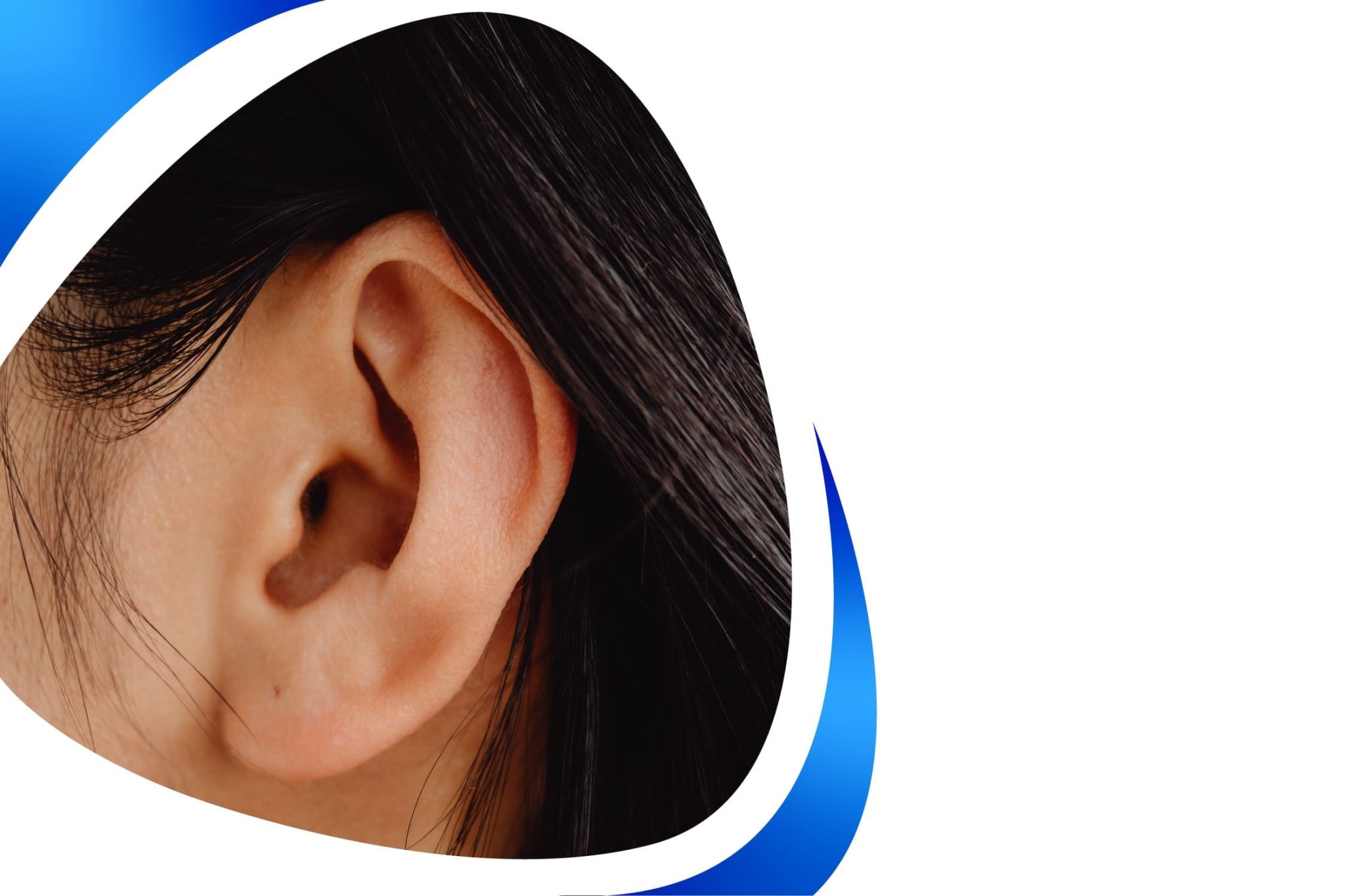 Prótesis de Oreja en Colombia